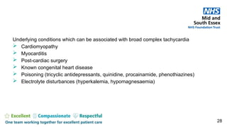 SVT presentation in children with ecg pictures | PPTX
