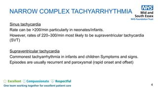 SVT presentation in children with ecg pictures | PPTX