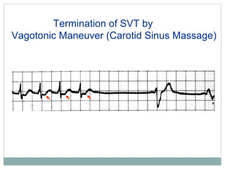 Svt and vm | PPT