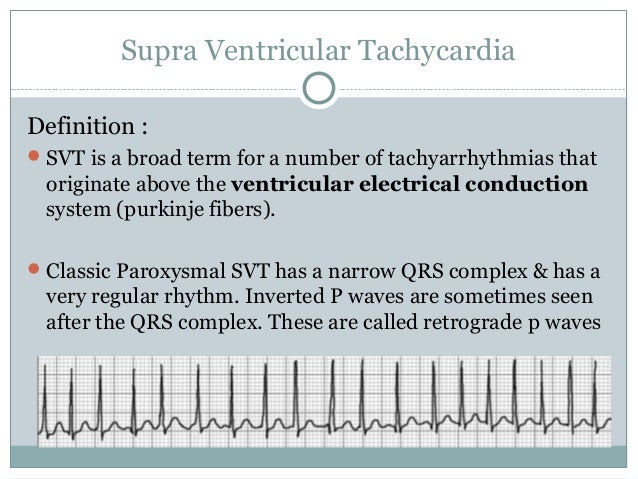 Svt and vm