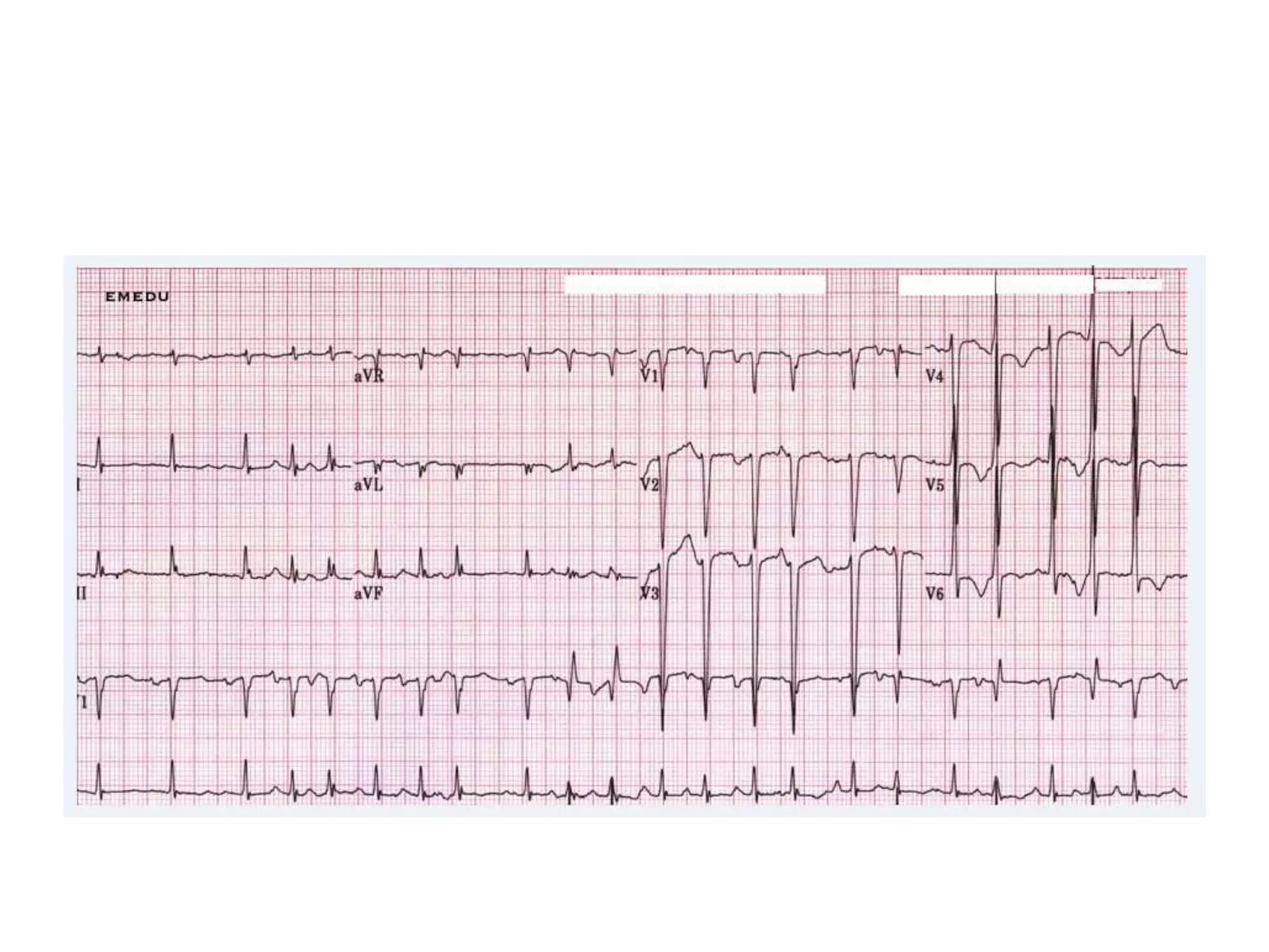 Svt evaluation | PPTX