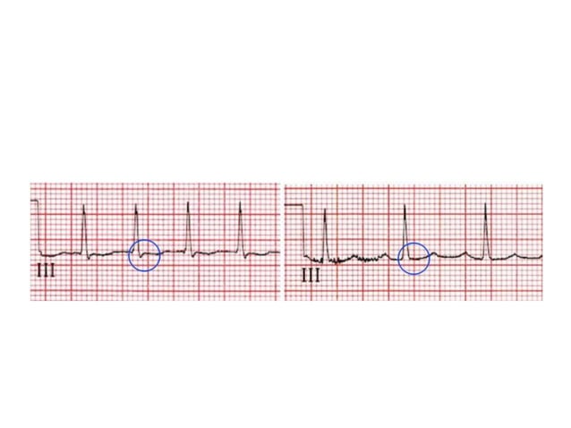 Svt evaluation | PPT