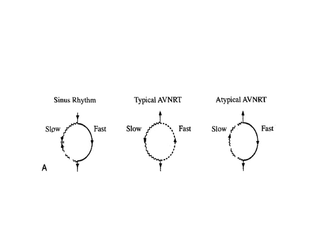 Svt evaluation | PPT