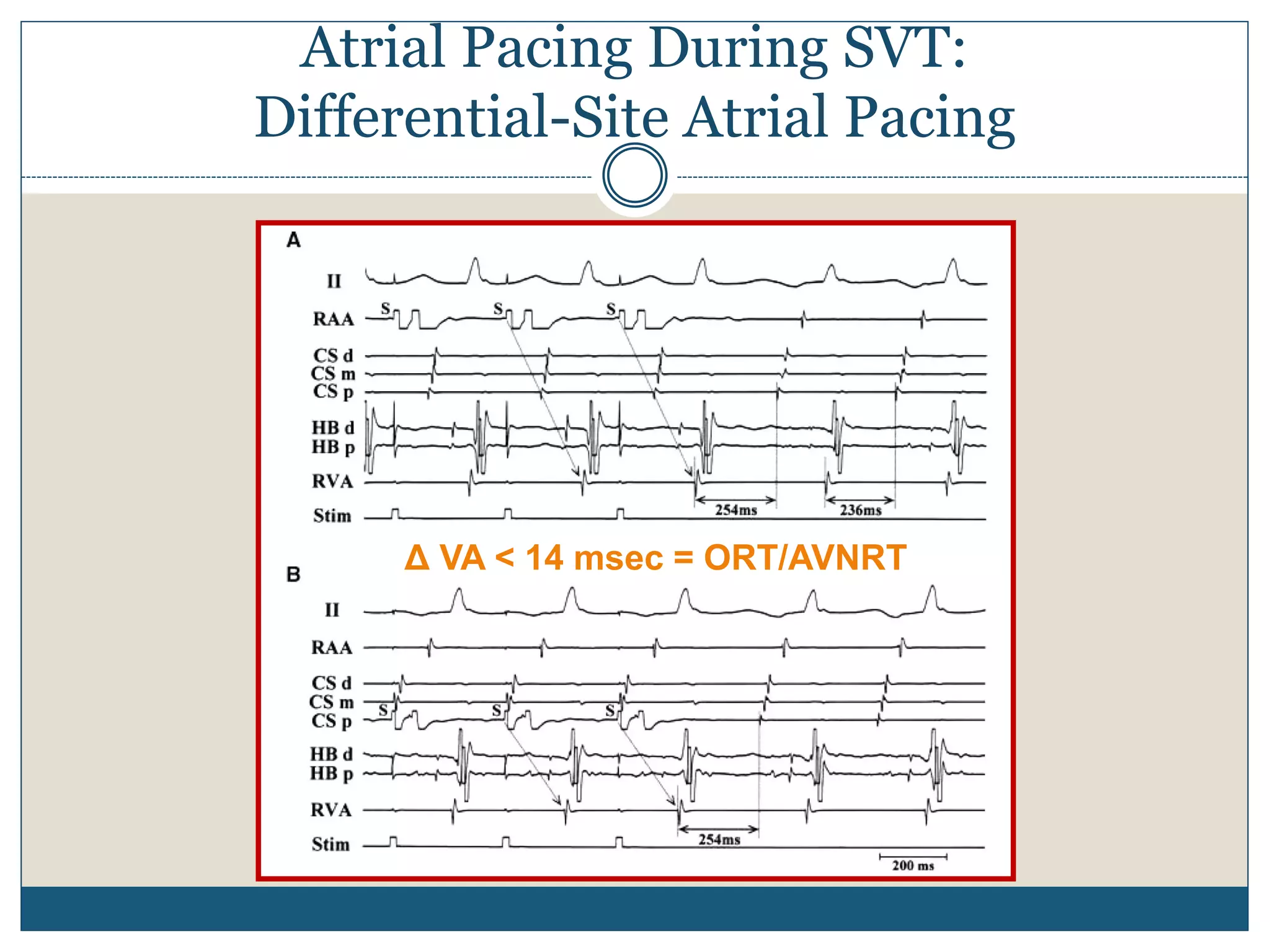 Svt maneuvers hany abed | PDF