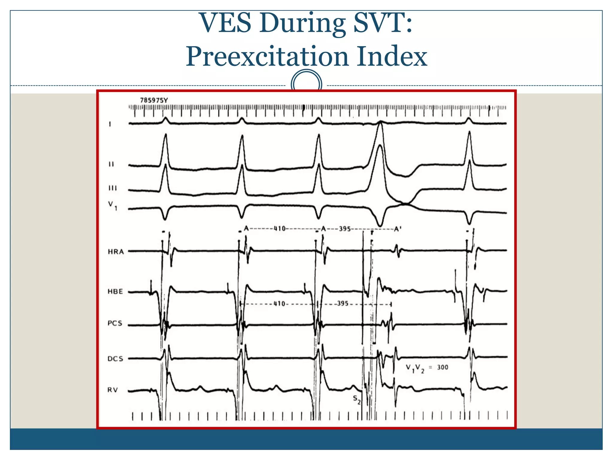 Svt maneuvers hany abed | PDF