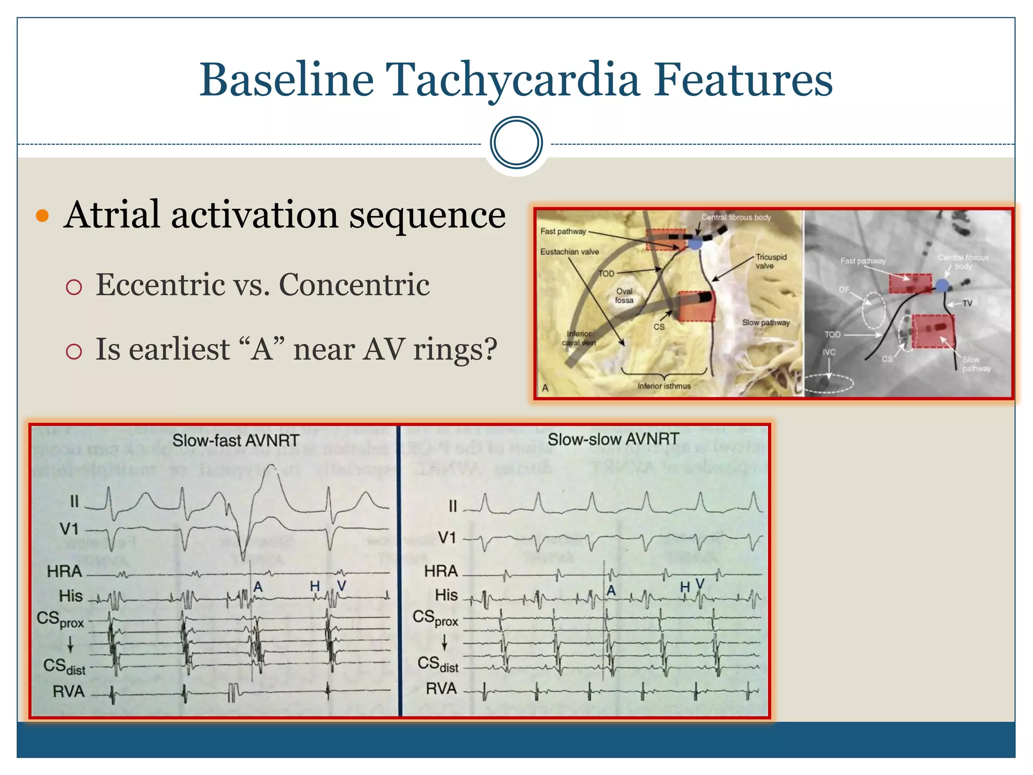 Svt maneuvers hany abed | PDF