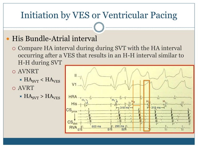 Svt maneuvers hany abed | PDF