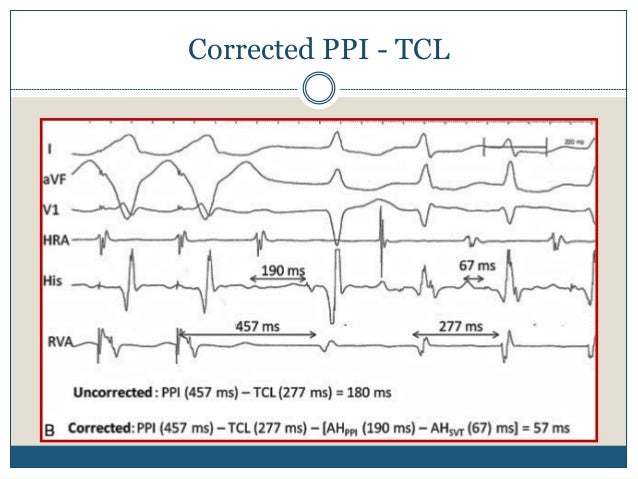 Svt maneuvers hany abed