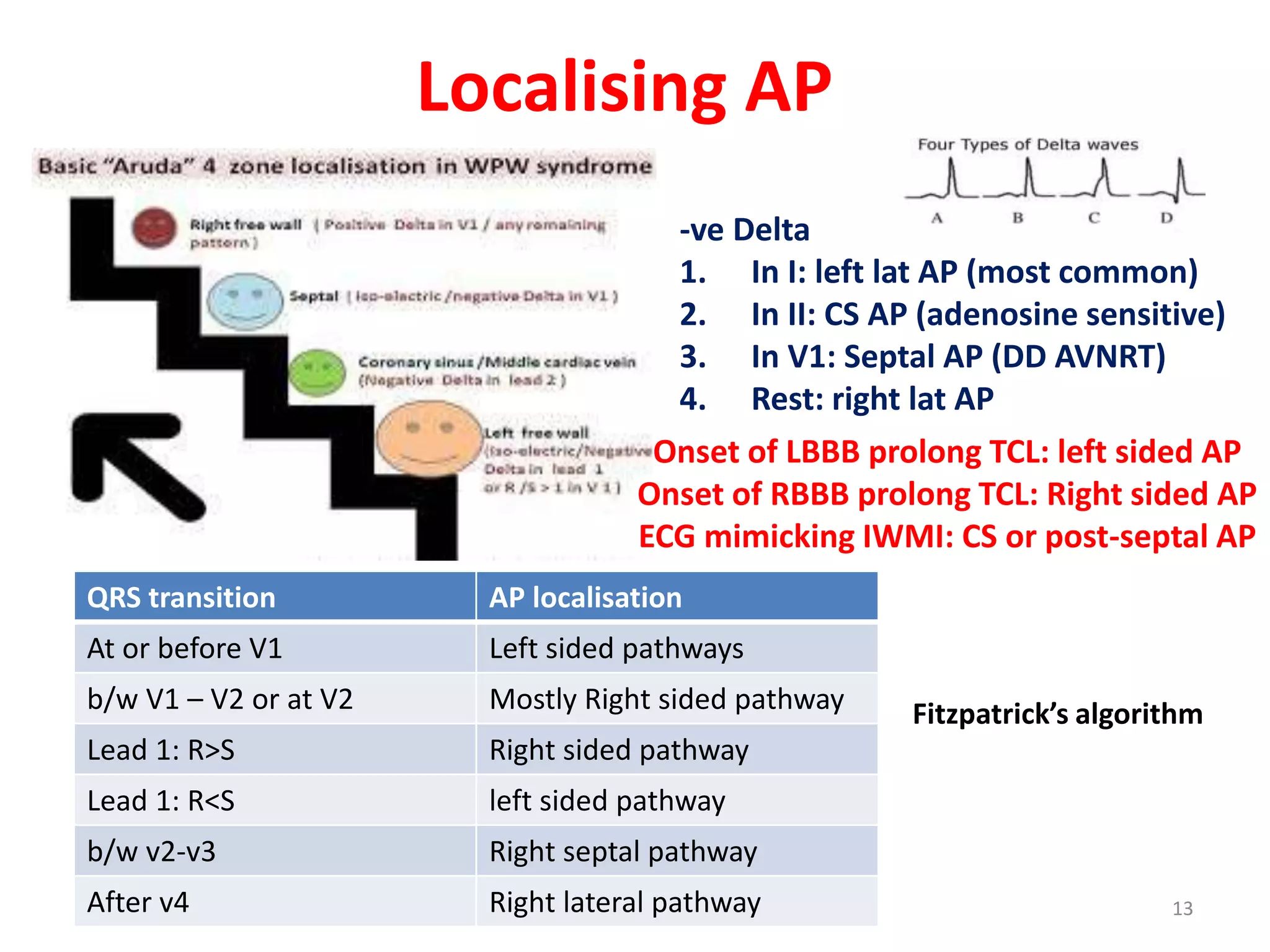 Supraventricular tachycardia: ECG recognition and diagnosis | PPTX