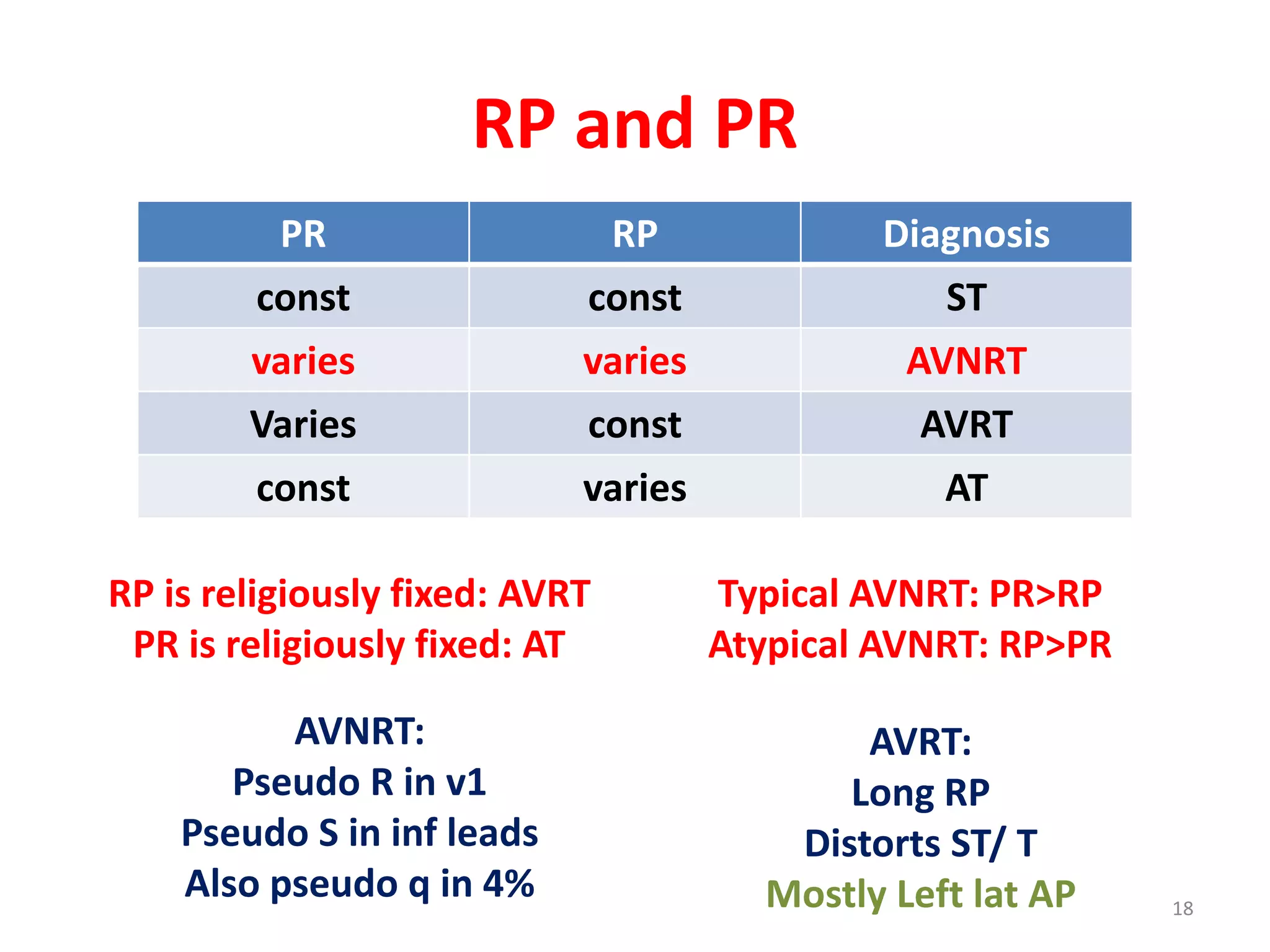 Supraventricular tachycardia: ECG recognition and diagnosis | PPTX