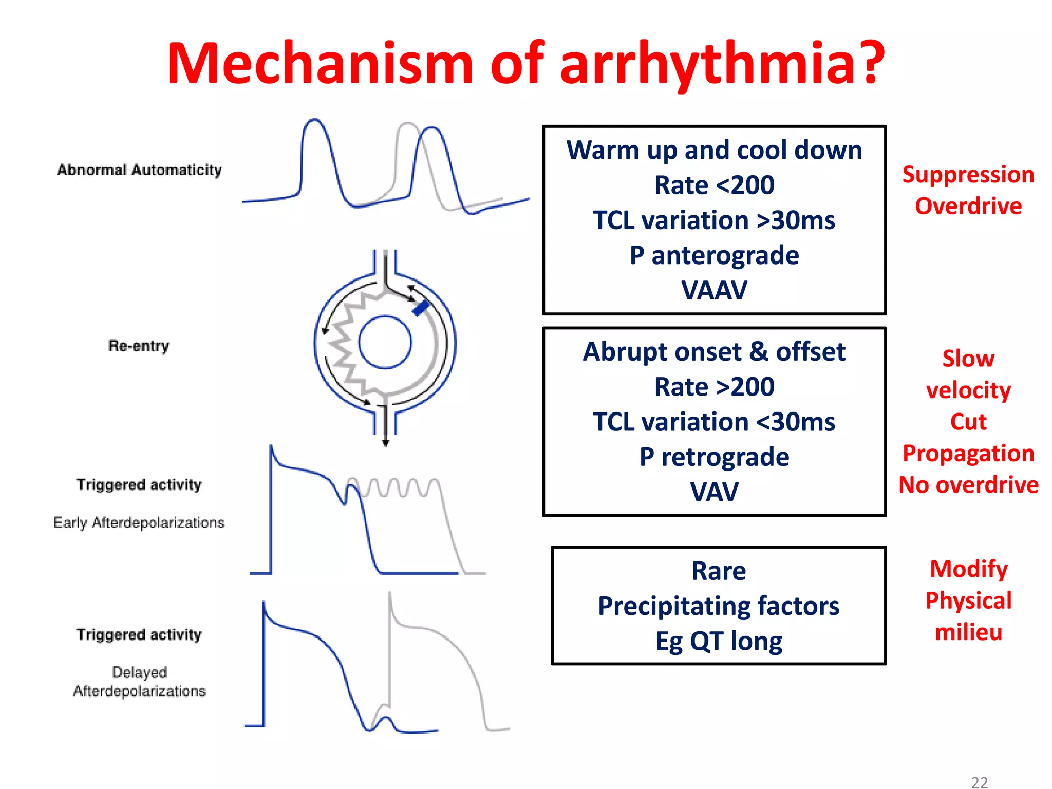Supraventricular tachycardia: ECG recognition and diagnosis | PPTX