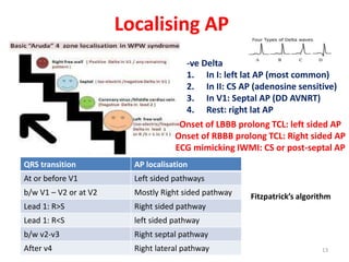 Supraventricular tachycardia: ECG recognition and diagnosis | PPTX
