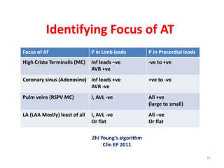 Supraventricular tachycardia: ECG recognition and diagnosis | PPTX