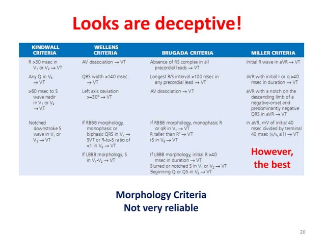 Supraventricular tachycardia: ECG recognition and diagnosis | PPTX