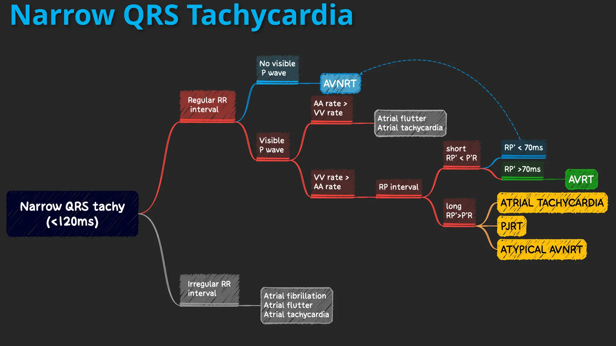 Supraventicular tachycardias ECG and diagnosis | PPT