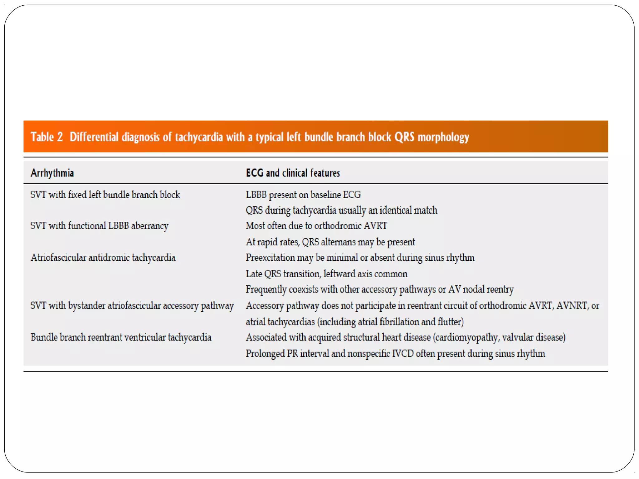 supraventricular tachycardia (SVT) with aberrancy | PPT