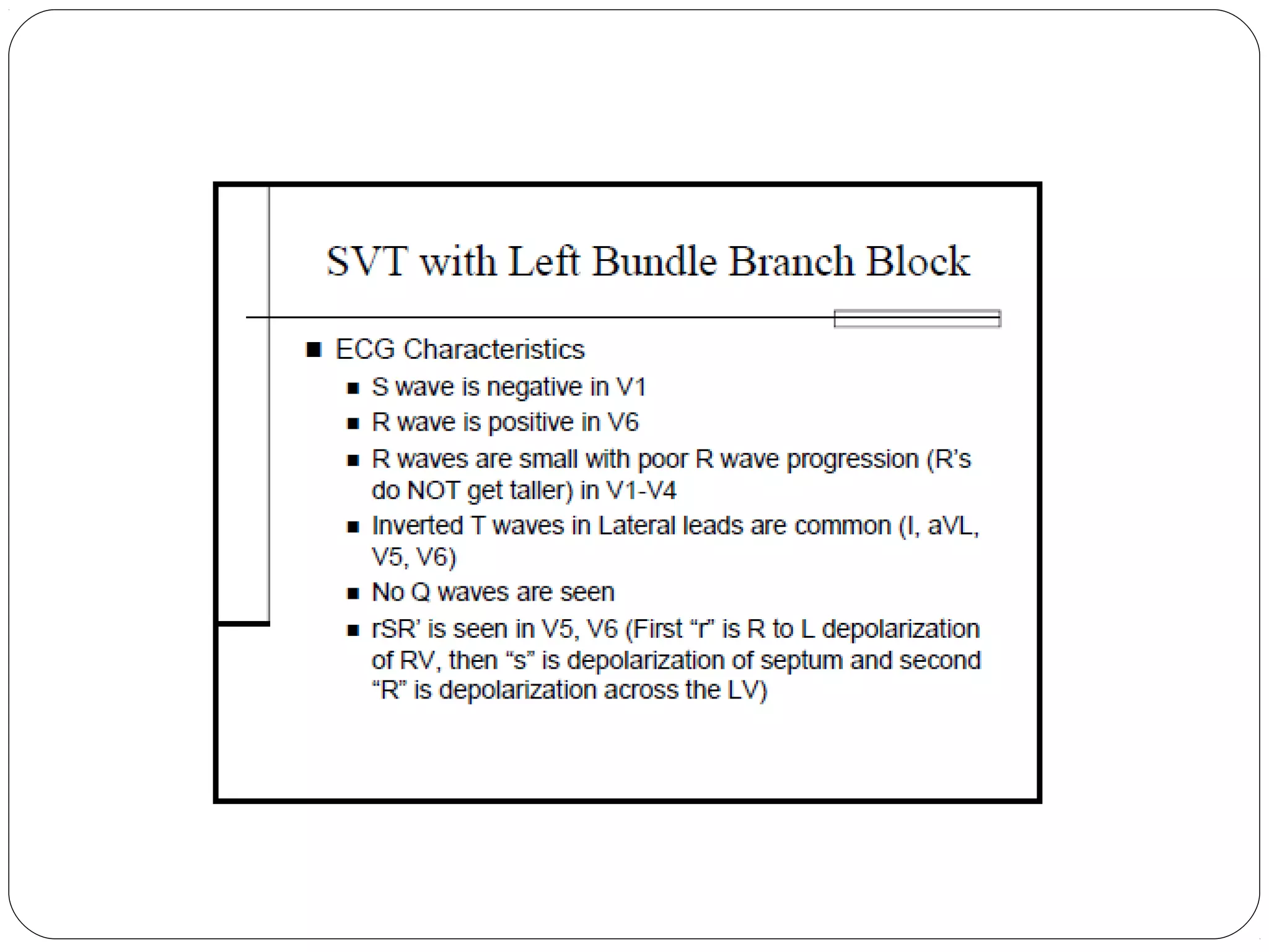 supraventricular tachycardia (SVT) with aberrancy | PPT