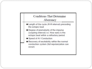 supraventricular tachycardia (SVT) with aberrancy | PPT
