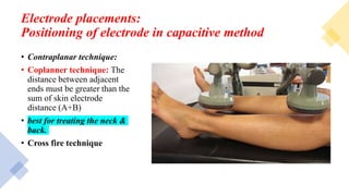 Short wave Diathermy | PPTX