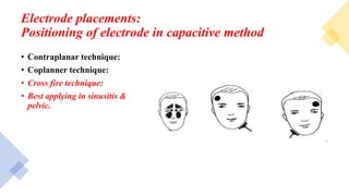 Short wave Diathermy | PPTX