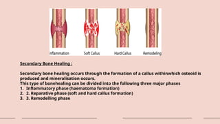 swagatam oral surgery bone graft djlkjsdlfjljl | PPT
