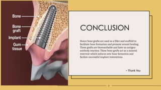 swagatam oral surgery bone graft djlkjsdlfjljl | PPT