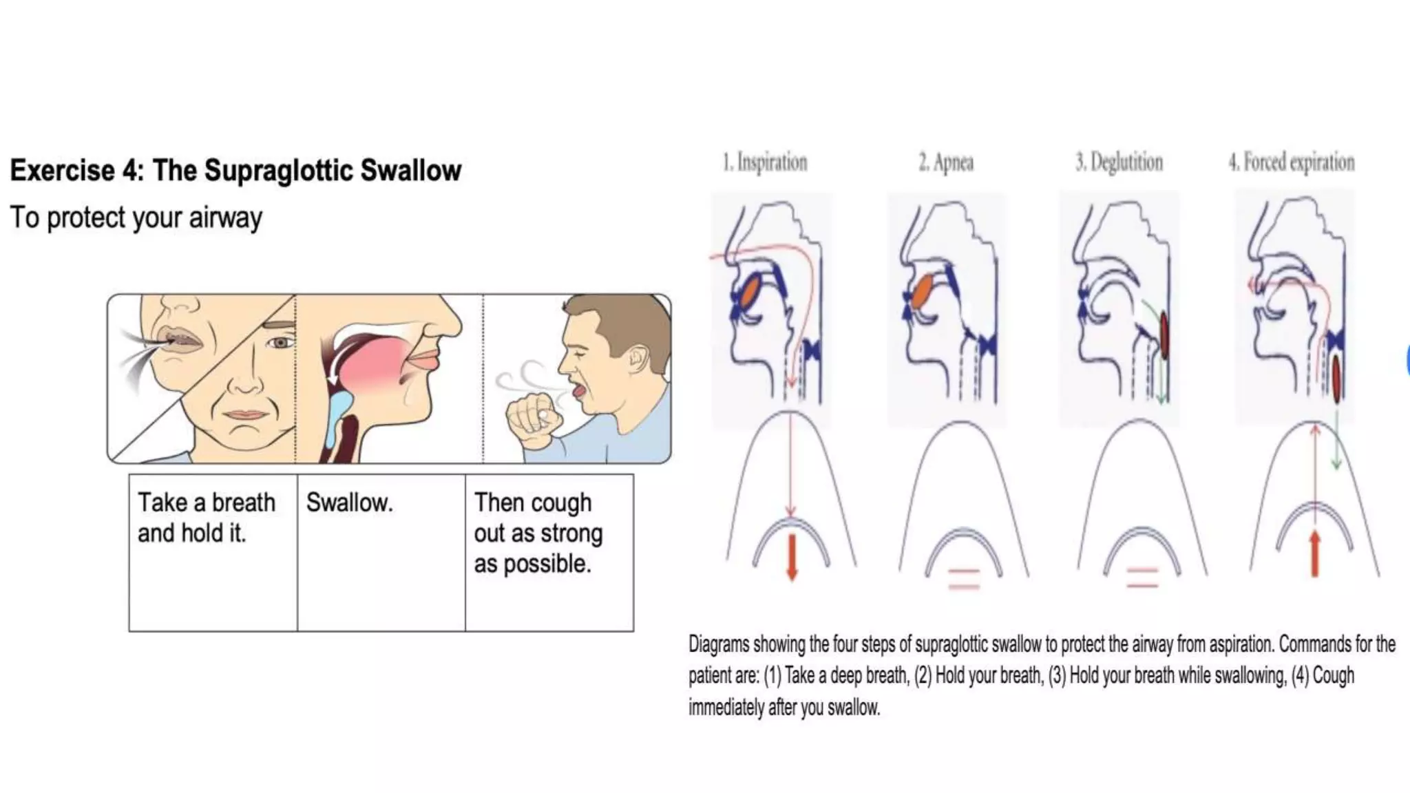 SWALLOWING AND VOICE REHABILITATION .pptx