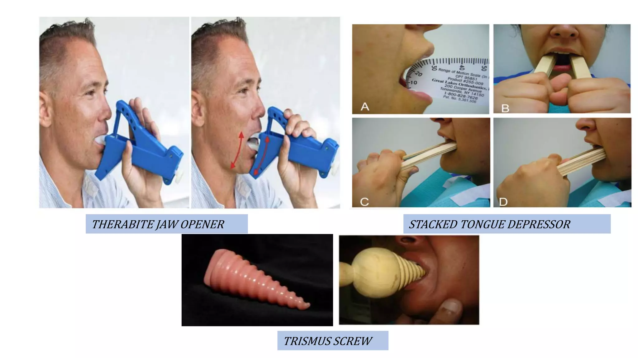 SWALLOWING AND VOICE REHABILITATION .pptx
