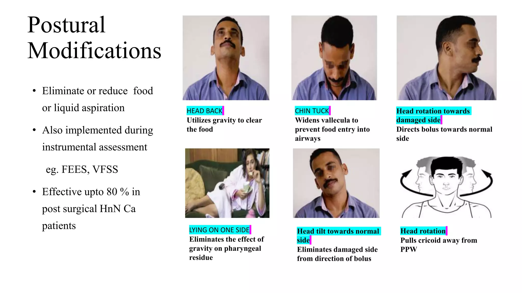 SWALLOWING AND VOICE REHABILITATION .pptx