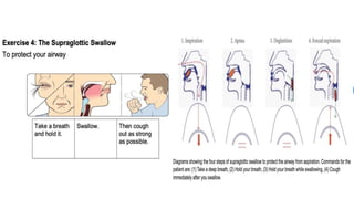 Supraglottic Swallow