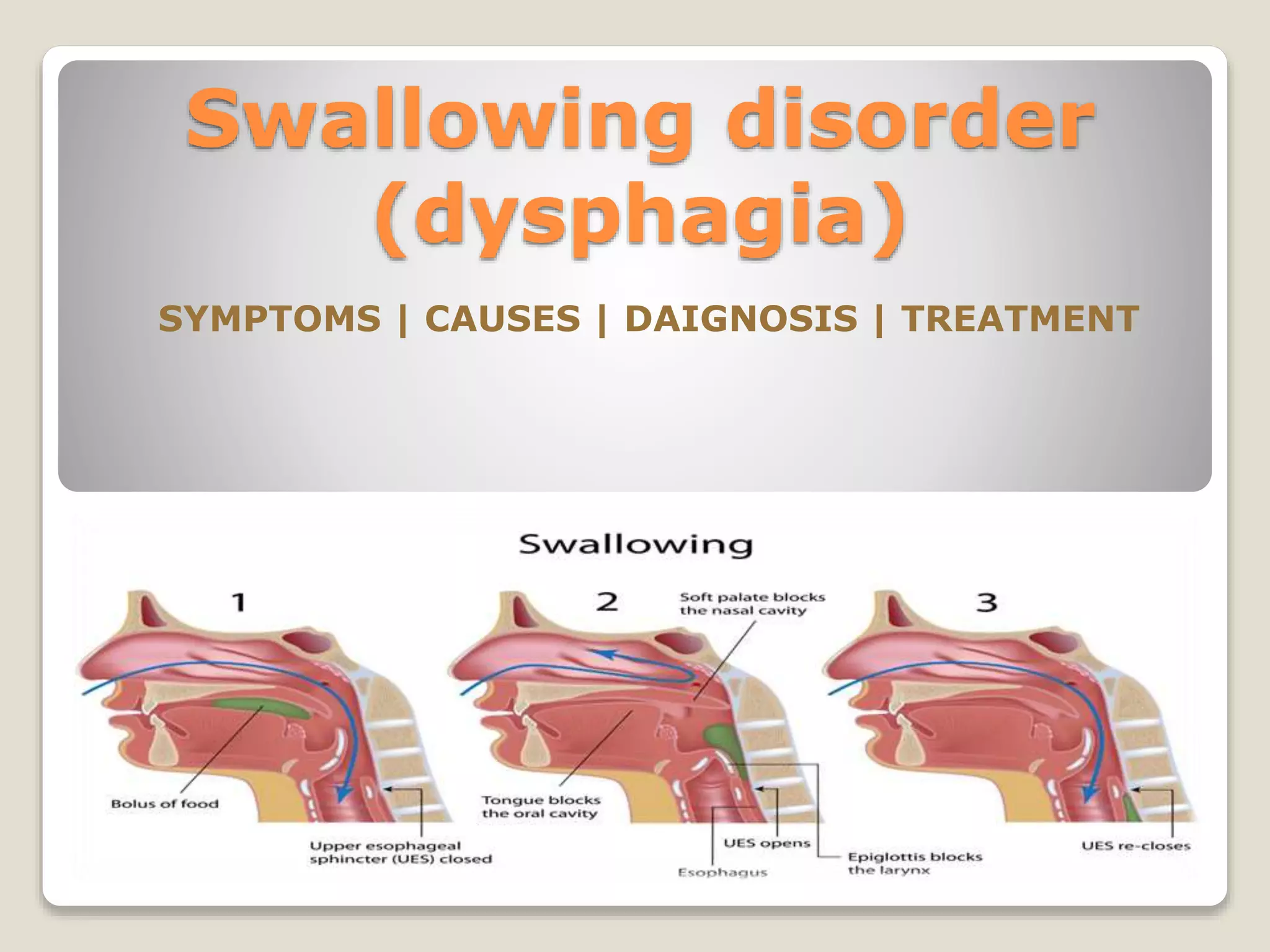 Swallowing disorder (dysphagia) in children- Causes, Symptoms ...