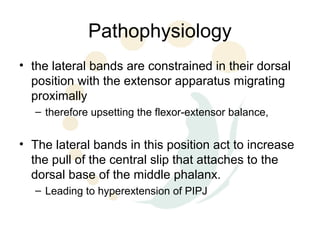 Swan neck-deformity | PPT