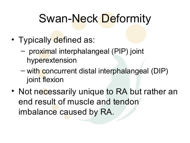 Swan neck-deformity
