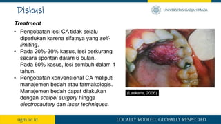 Oral Condyloma Acuminatum | PPTX
