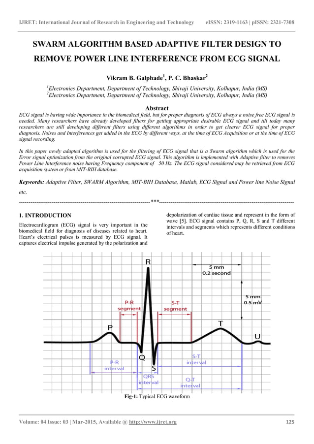 Swarm algorithm based adaptive filter design to remove power line interference from ecg signal | PDF
