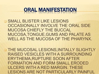 CHICKEN POX DISESES | PPTX