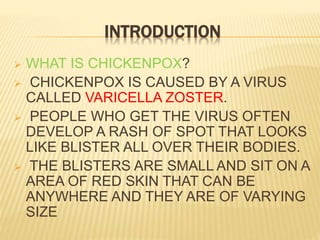 CHICKEN POX DISESES | PPTX