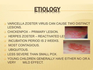 CHICKEN POX DISESES | PPTX