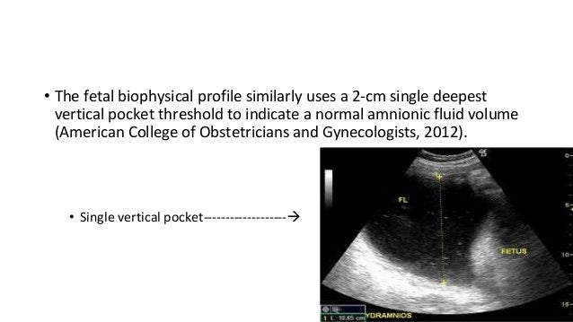 AMNIOTIC FLUID PPT