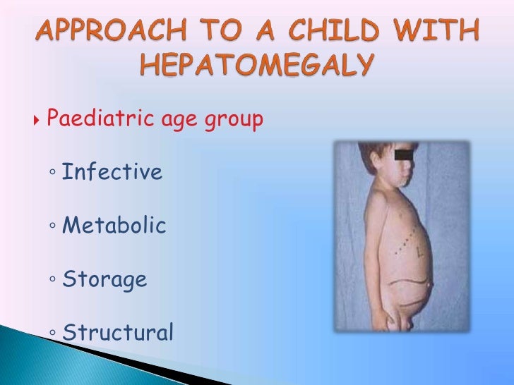 Dr Swati- Case of Hepatomegaly