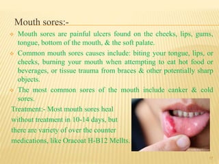 Oral cavity related problems | PPT