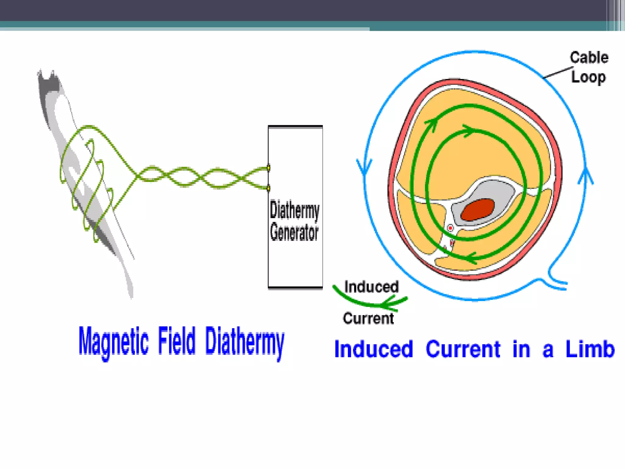 SHORT WAVE DIATHERMY (SWD) | PPTX