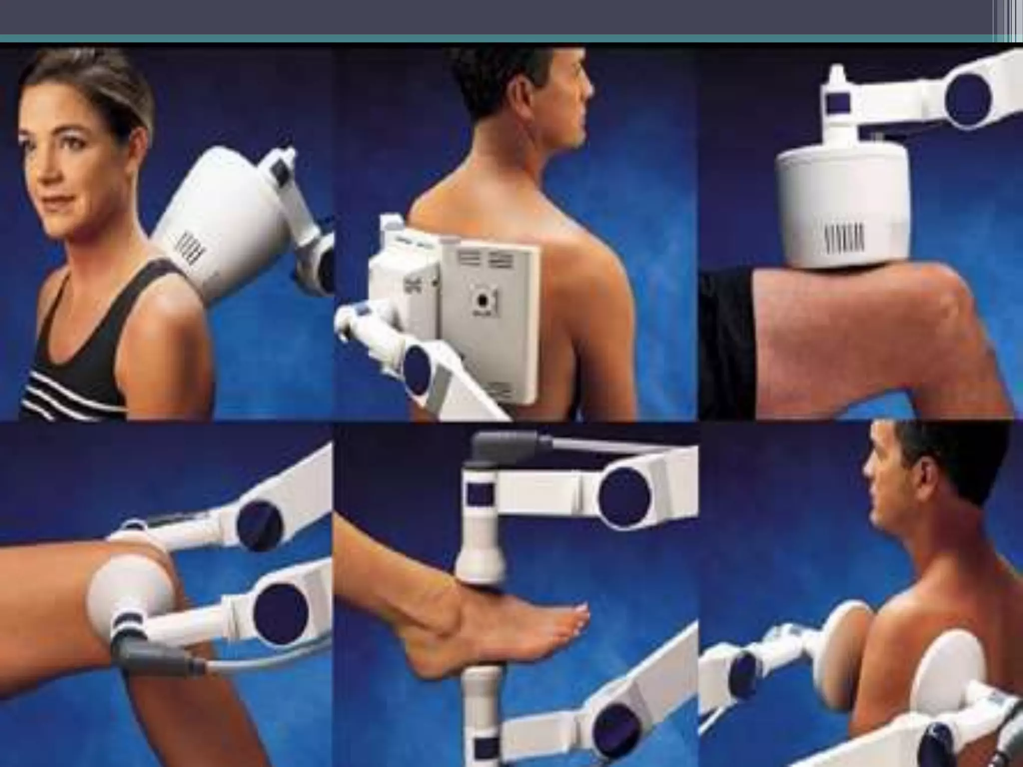 SHORT WAVE DIATHERMY (SWD) | PPTX