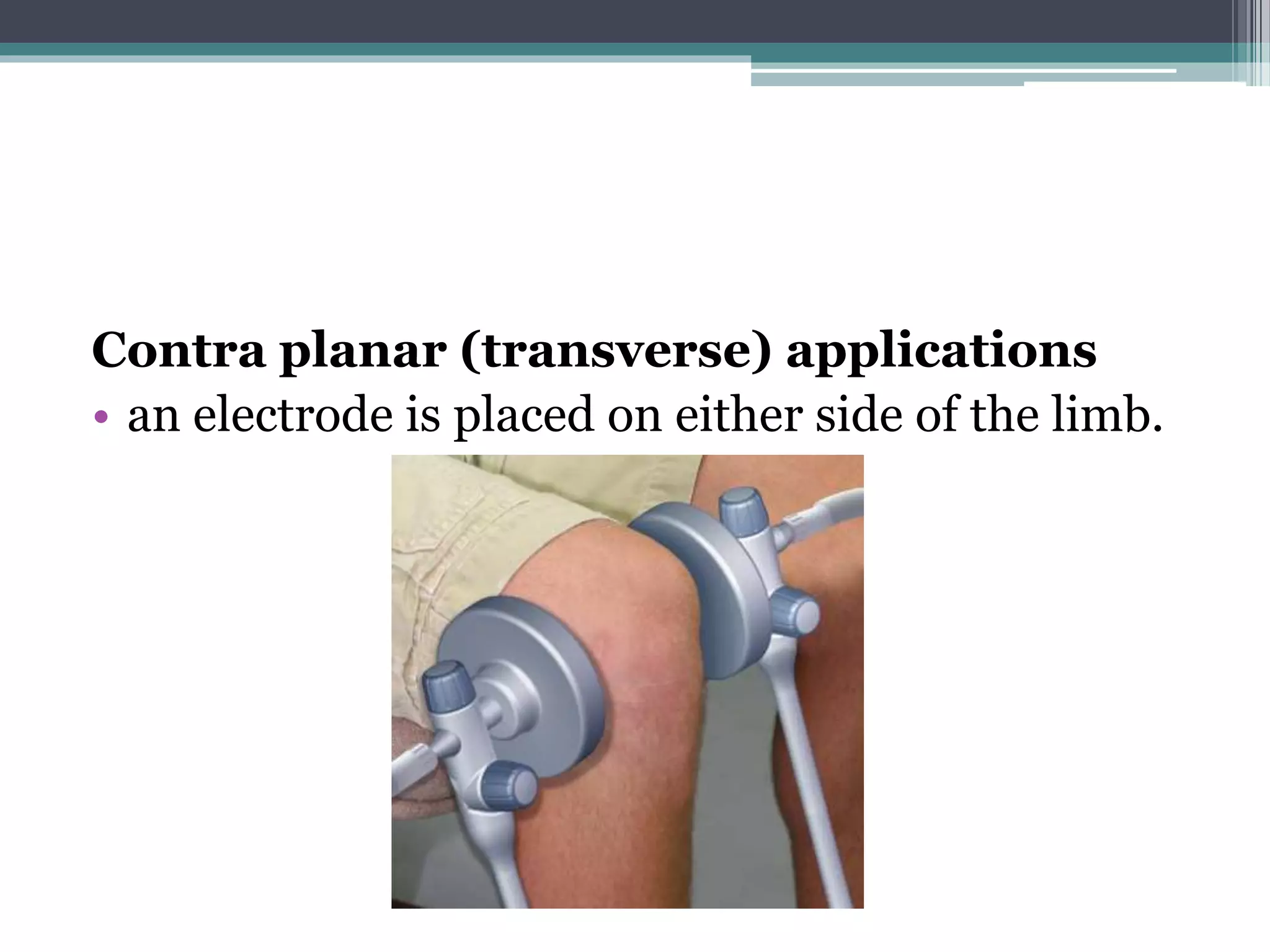 SHORT WAVE DIATHERMY (SWD) | PPTX