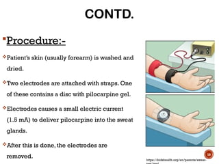 Sweat Test : A Diagnostic Tool for Cystic Fibrosis | PPT