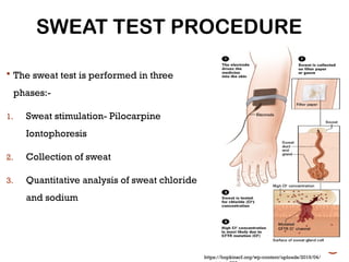 Sweat Test : A Diagnostic Tool for Cystic Fibrosis | PPT