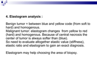 SHEAR WAVE ELASTOGRAPHY of BREAST TUMORS | PPT