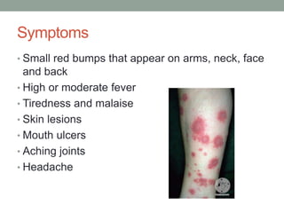 Sweet's syndrome | PPTX