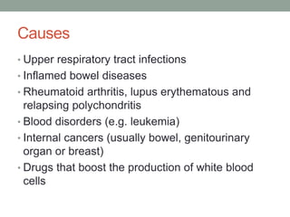 Sweet's syndrome | PPTX
