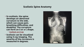 scoliosis and nursing management .pptx